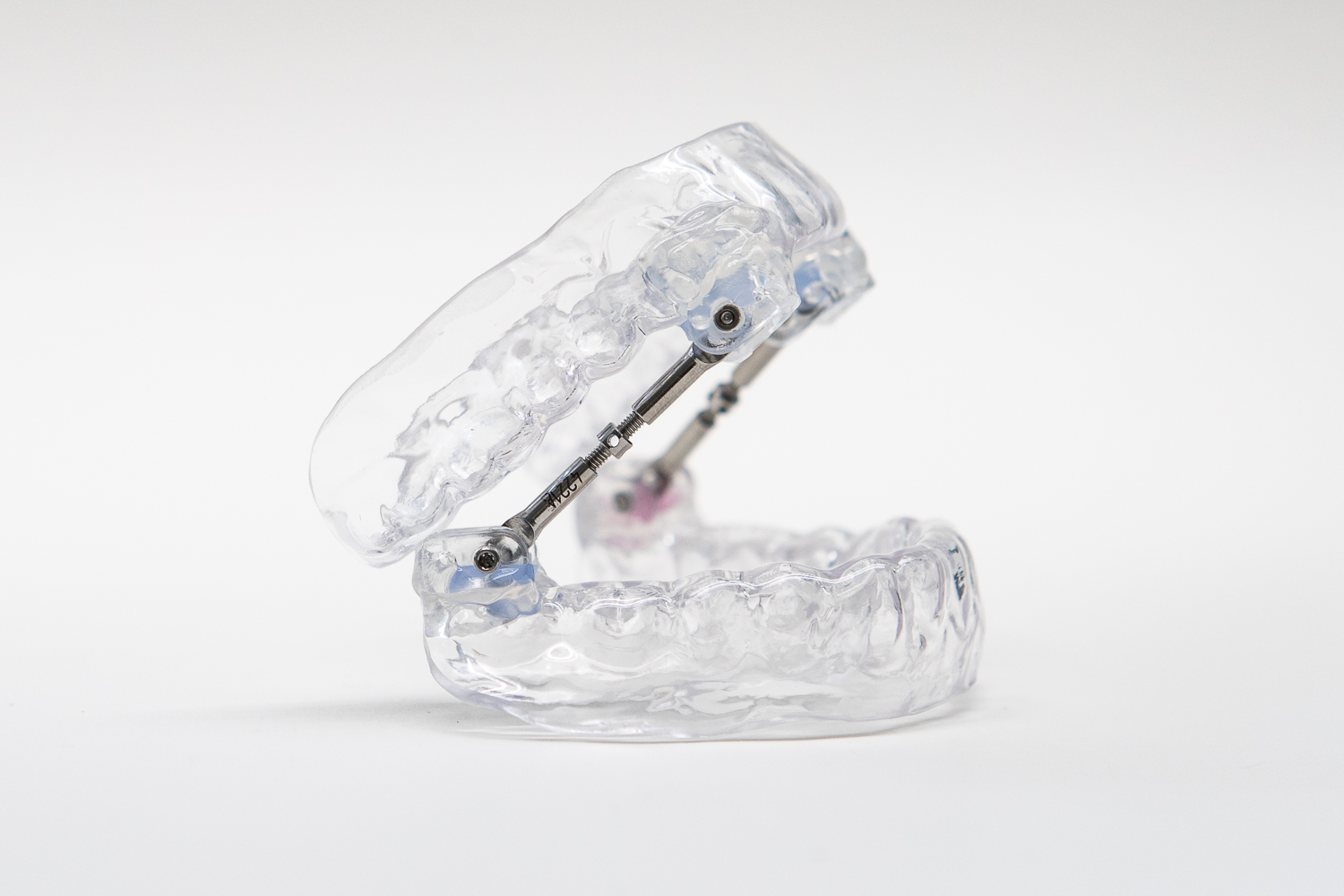 UKPS / Schnarchschiene - Wilhelmy Zahntechnik